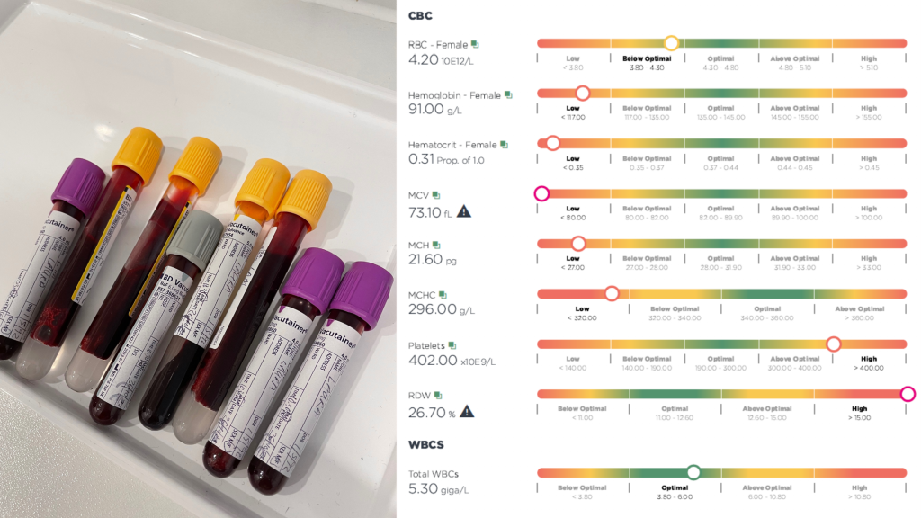 Recommended Blood Test List | Functional Blood Analysis